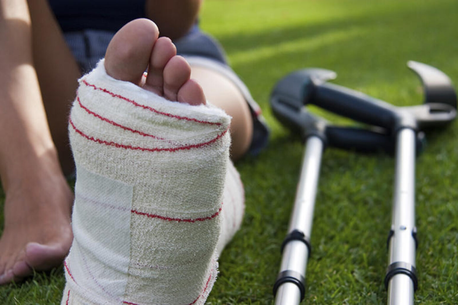 When Should Cast Discomfort Be A Concern? | Summit Orthopedics