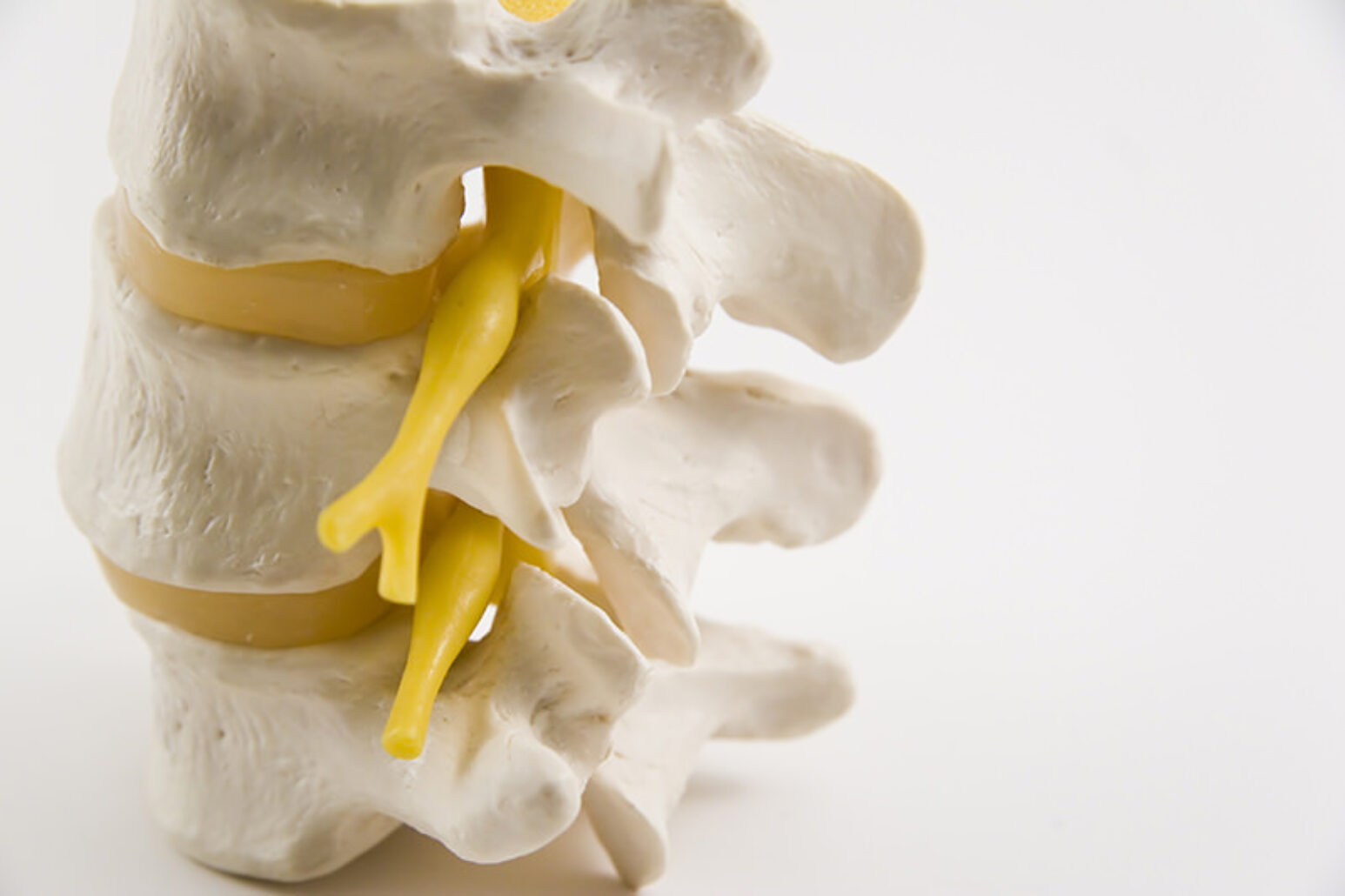 Benefits Of Cervical Disc Replacement | Summit Orthopedics