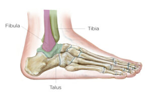 Ankle Surgery | Summit Orthopedics