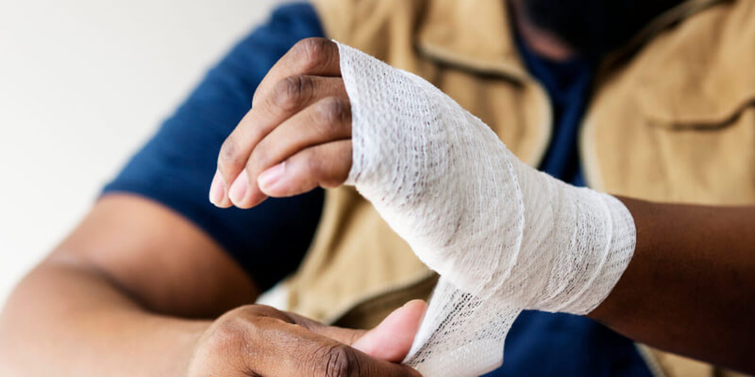 What Is “Avocado Hand”? | Summit Orthopedics