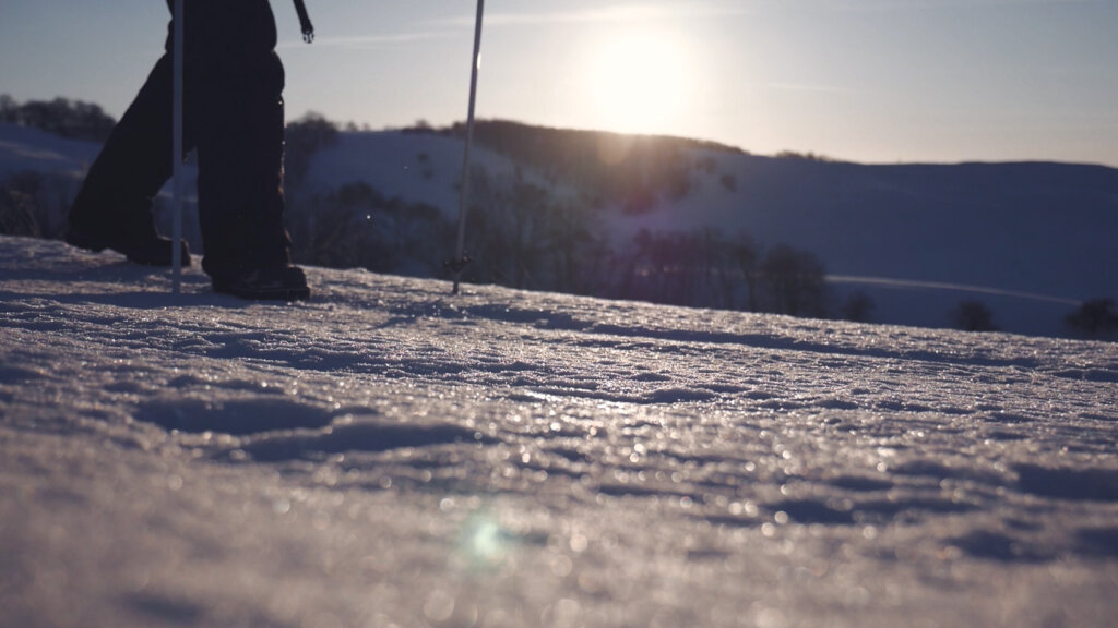 Dr. Dane Hansen Compares Hip Resurfacing and Total Hip Replacements